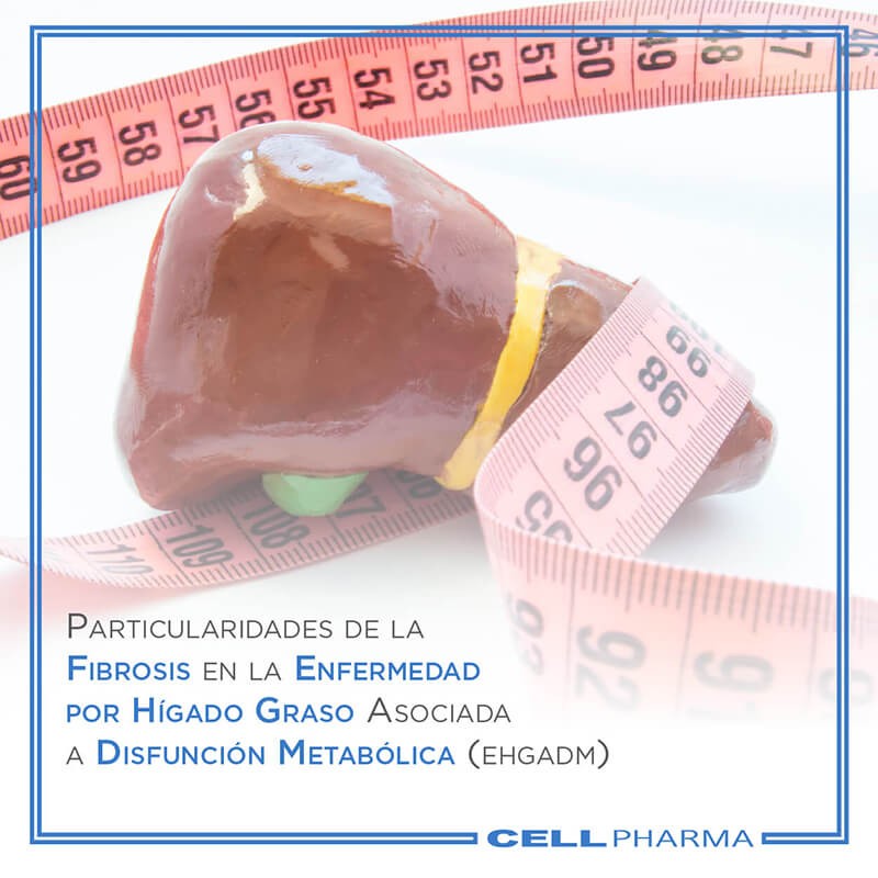 Enfermedad por Hígado Graso Asociada a Disfunción Metabólica.